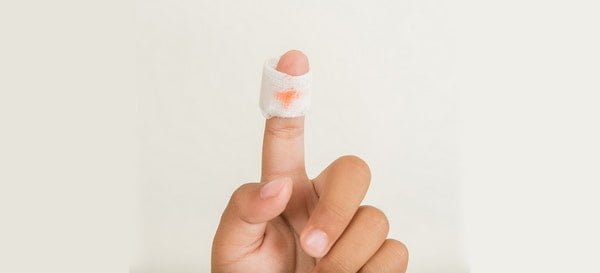 4 Jenis Luka Terbuka yang Perlu Diketahui Sekiranya Berlaku Kemalangan